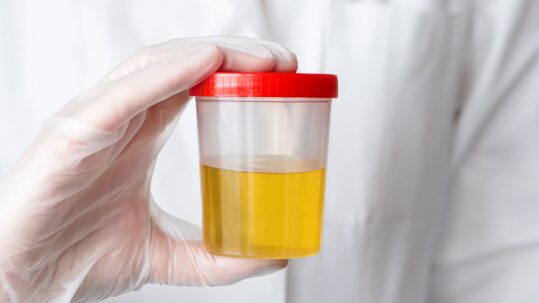 DOT Urine Specimen Collection Guidelines & Procedure | Importance & More