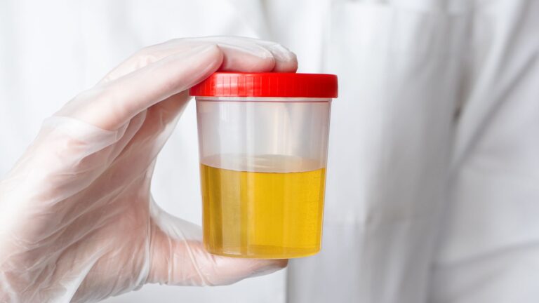 DOT Urine Specimen Collection Guidelines & Procedure | Importance & More